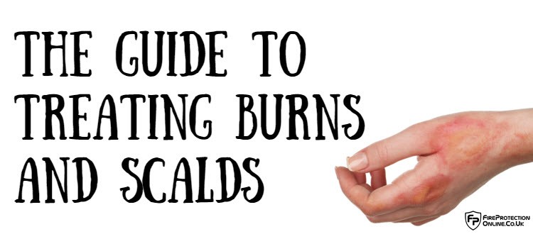 The Guide To Treating Burns And Scalds - Fire Safety Information